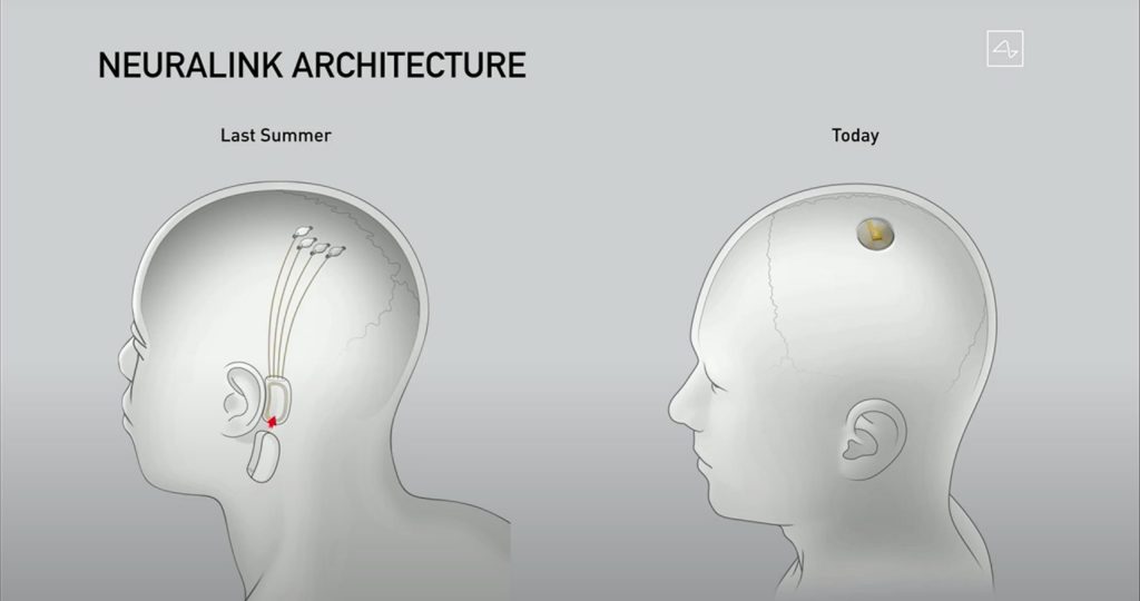Elon Musk 2020 Update (Neuralink) N2 1 (c) - TESLARATI Elon Musk 2020 Update (Neuralink) N2 1 (c) - TESLARATI